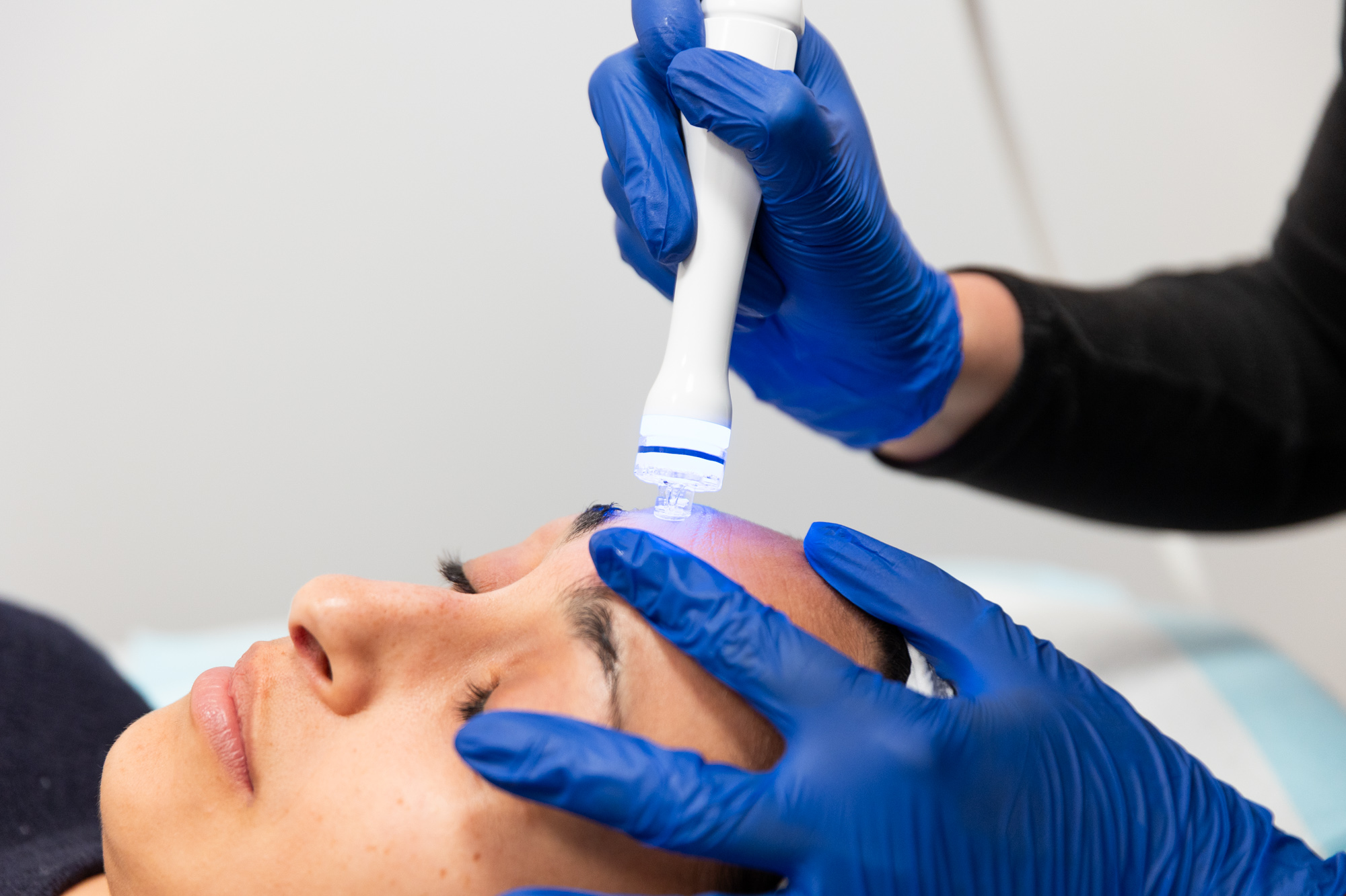 Medical Facials in Ultimo, Sydney | Dr Refresh