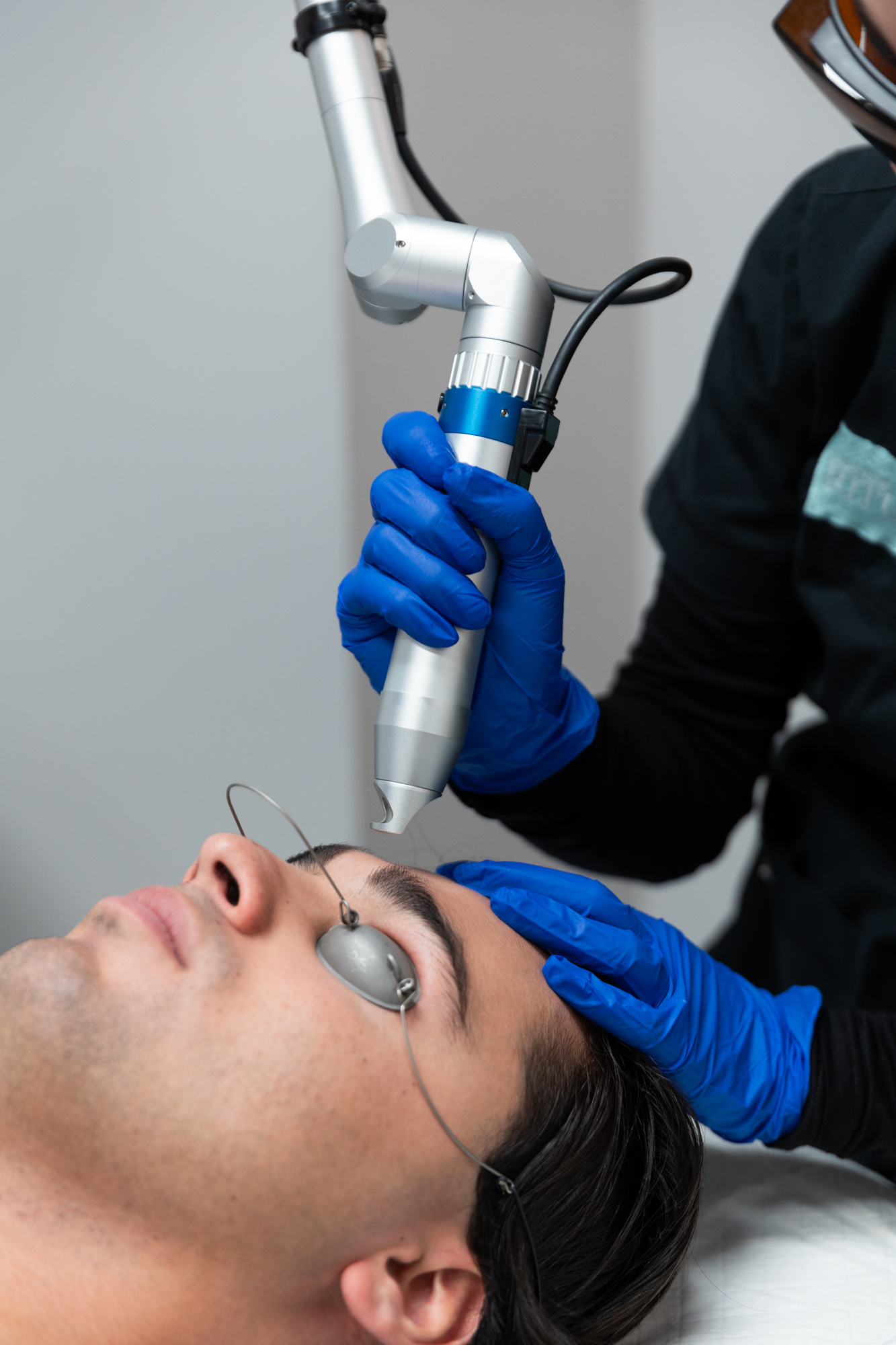 Acne Scar Treatment in Ultimo | Dr Refresh