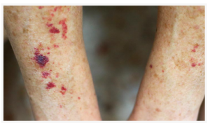 When Is a Rash Serious? Dermatologist's Advice on When to Seek Help ...